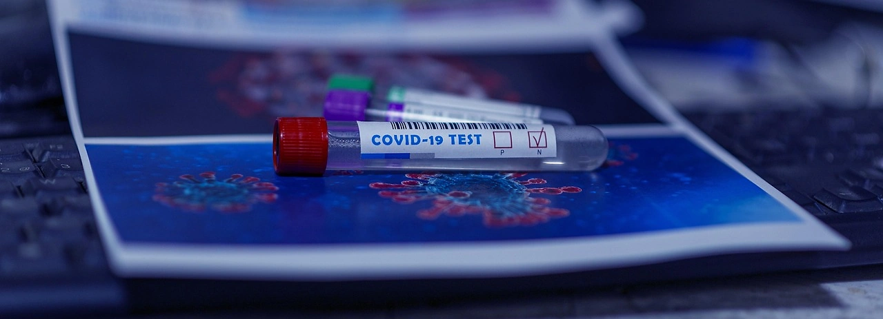 Counterfeit COVID-19 & Flu Self-Tests Found in Europe, Spanish Agency Warns