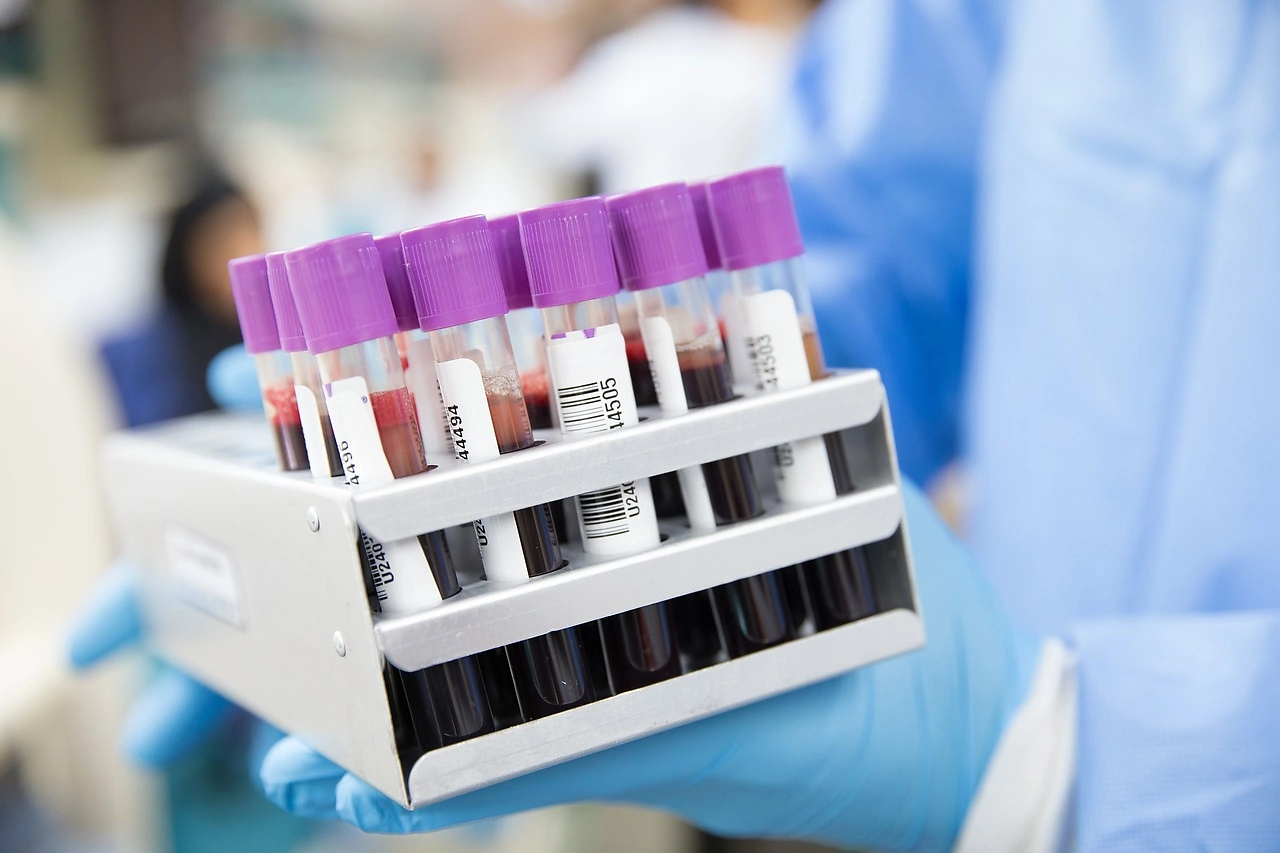 Bio-Techne Shares Drop 6.5% After Q4 Fiscal 2025 Results