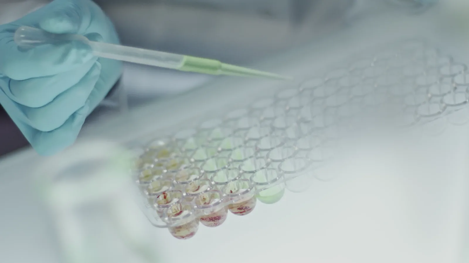 Labcorp's Growth Challenges vs. Procter & Gamble and Parker Hannifin's Strength
