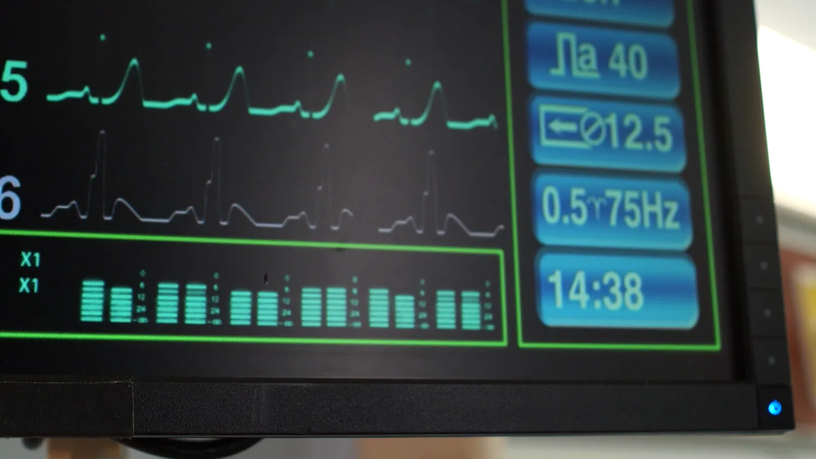 Whoop Shifts Focus from Athletic Performance to Health Monitoring